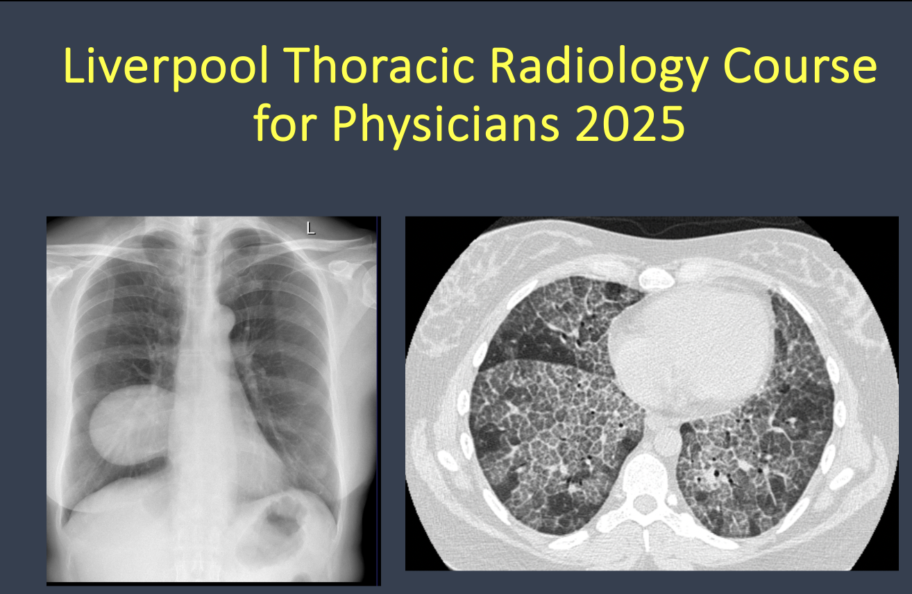 Liverpool Thoracic Radiology Course for Physicians 2025 episode 1 ...