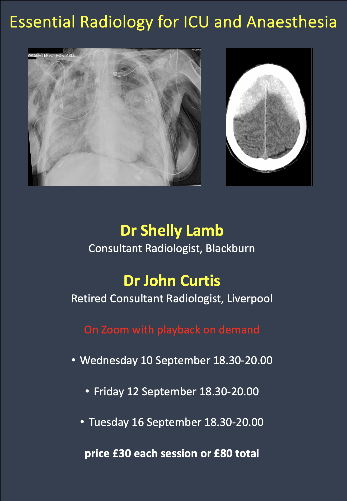 Essential Radiology for ICU and Anaesthesia - all 3 episodes (all 3 ...