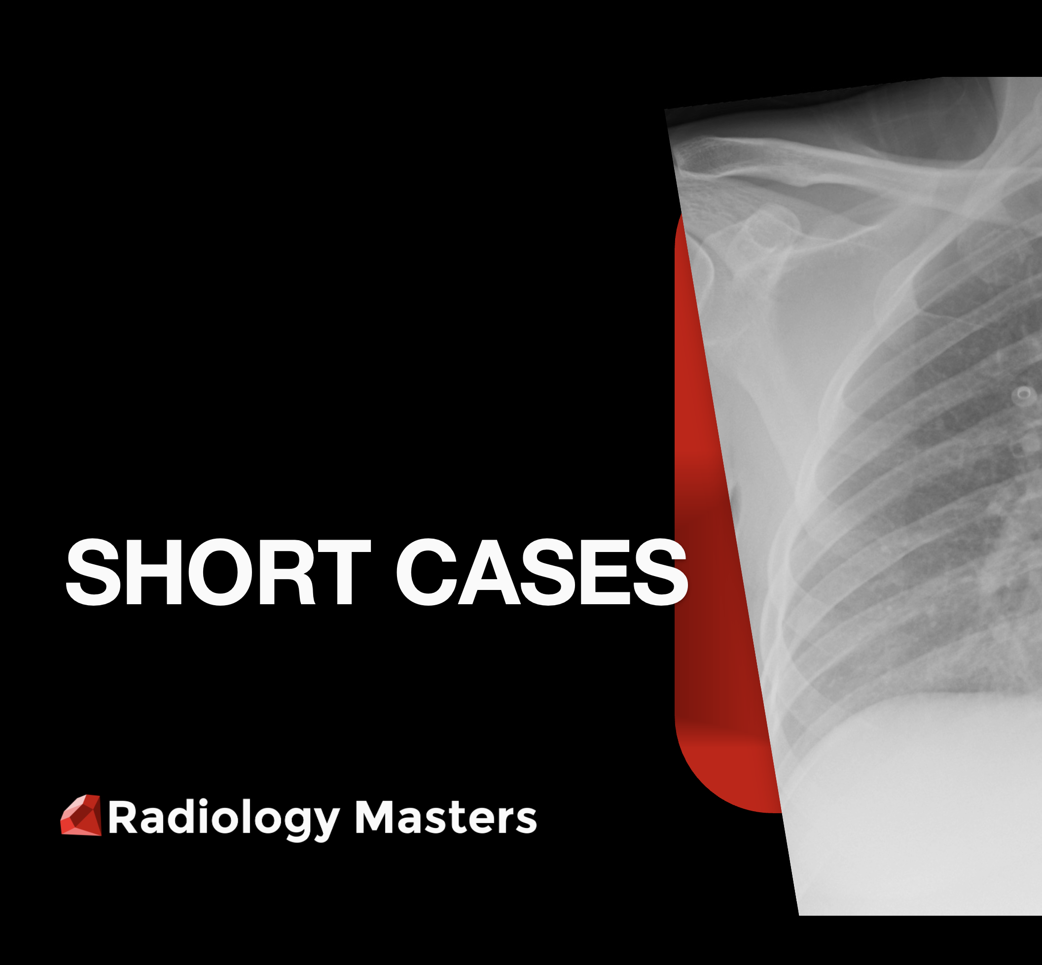 Short Cases for FRCR 2B (1-5) ....6th packet on the way